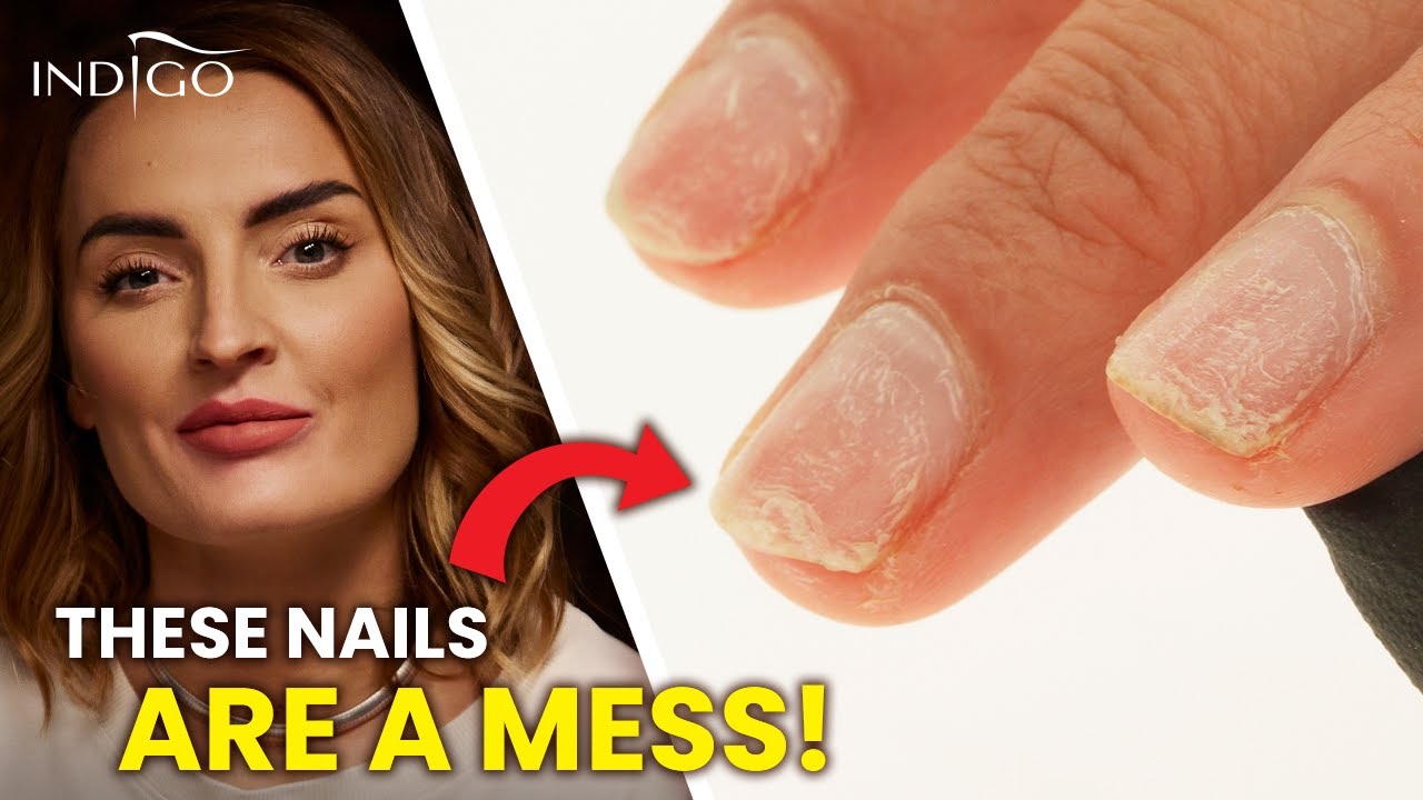 These NAILS are a MESS! – a repair of a damaged nail step by step ...