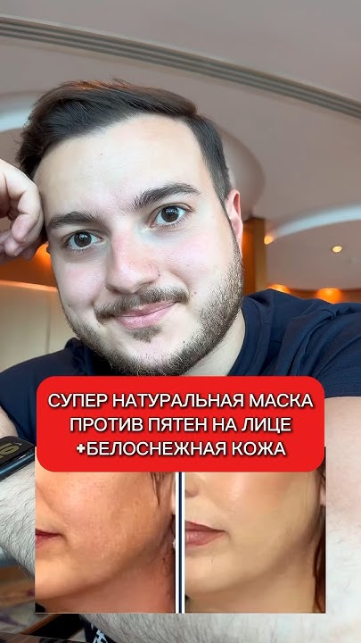 Супер маска для чистки и отбеливания кожи лица #исмаилгусейнли - YouTube