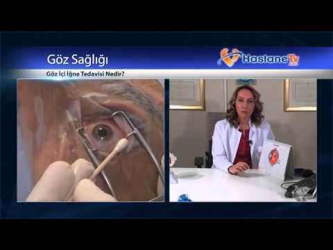 Göz İçi İğne Tedavisi Nedir?