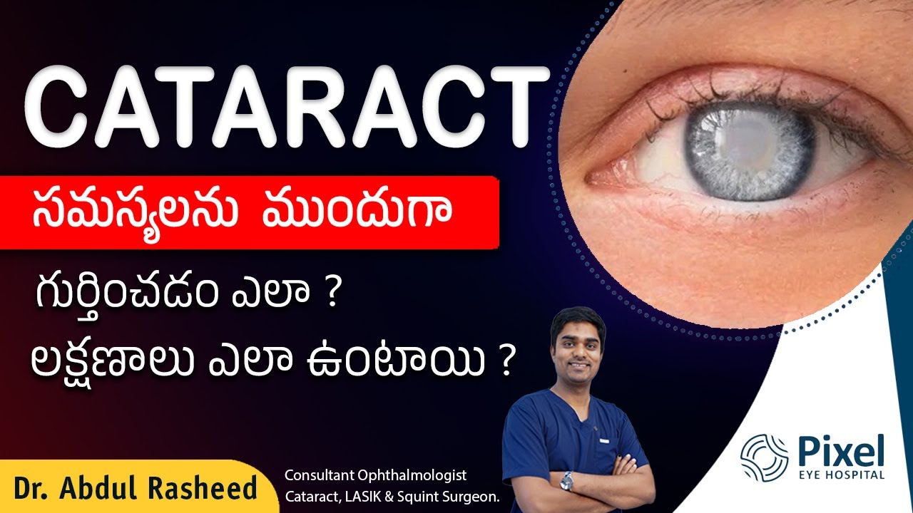 Symptoms of cataract | How to find cataract in eye | Cataract surgery ...