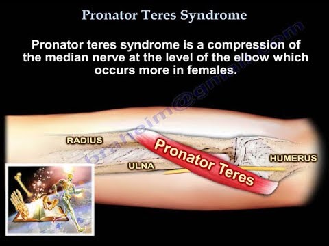Pronator Teres Syndrome - Everything You Need To Know - Dr. Nabil Ebraheim