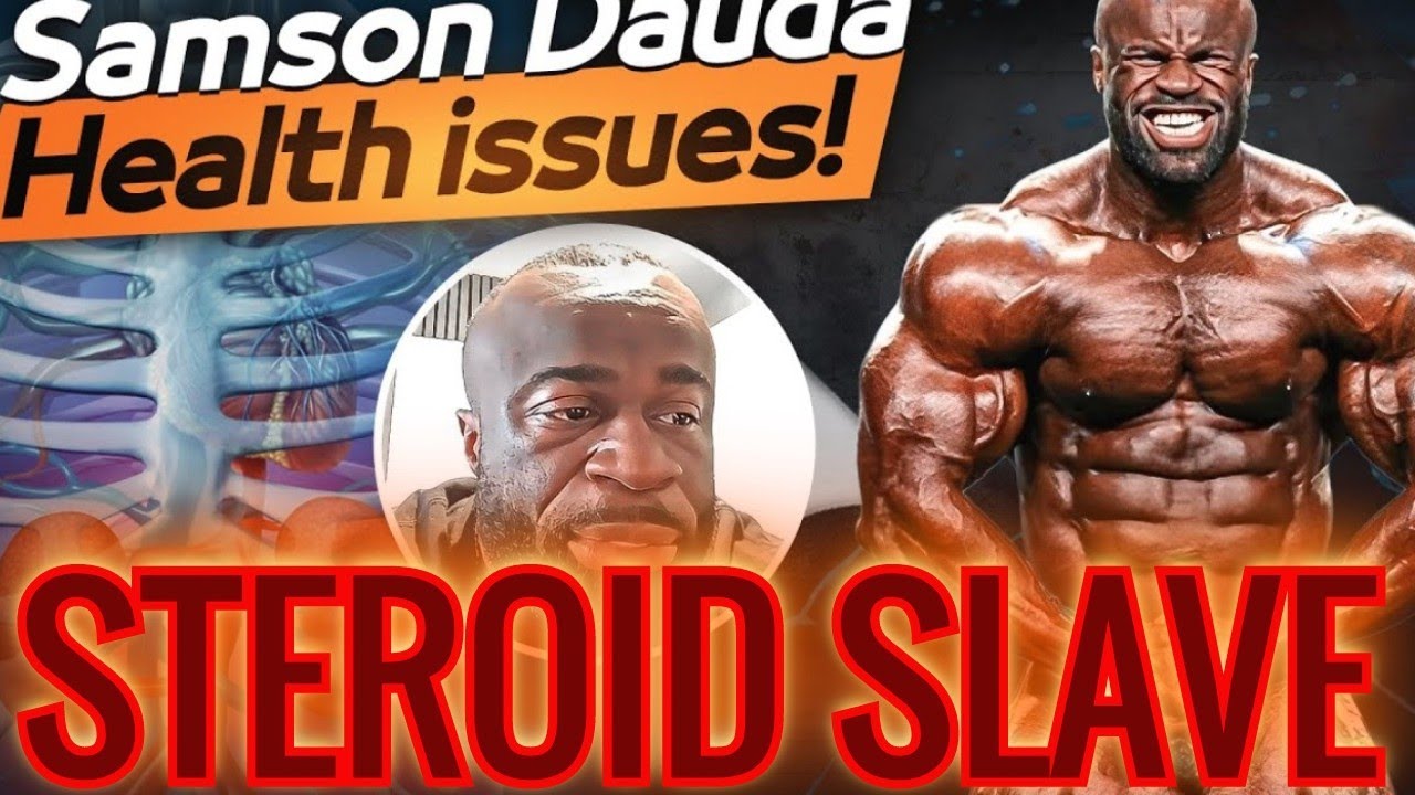 Samson Dauda STEROID SLAVE Top 3 Olympian About To Die From Injecting ...