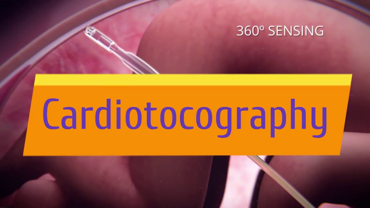 Cardiotocography Trailer - YouTube