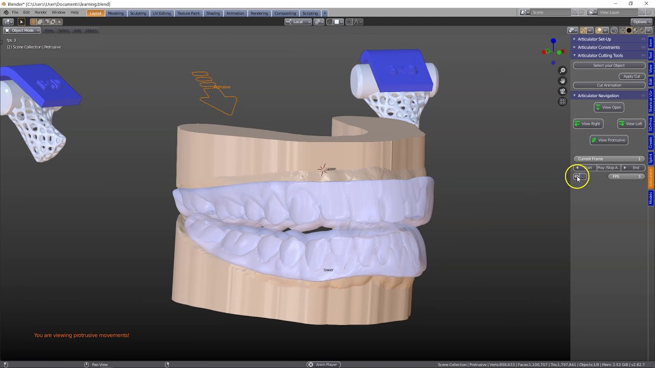 B4D Articulation and Splint - YouTube