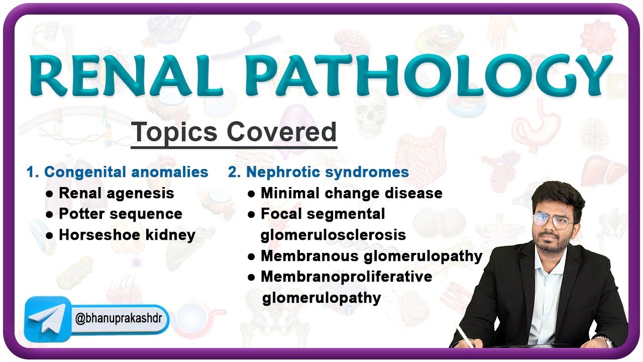 🌟 Exploring Renal Pathology: Congenital Anomalies & Nephrotic Syndromes ...