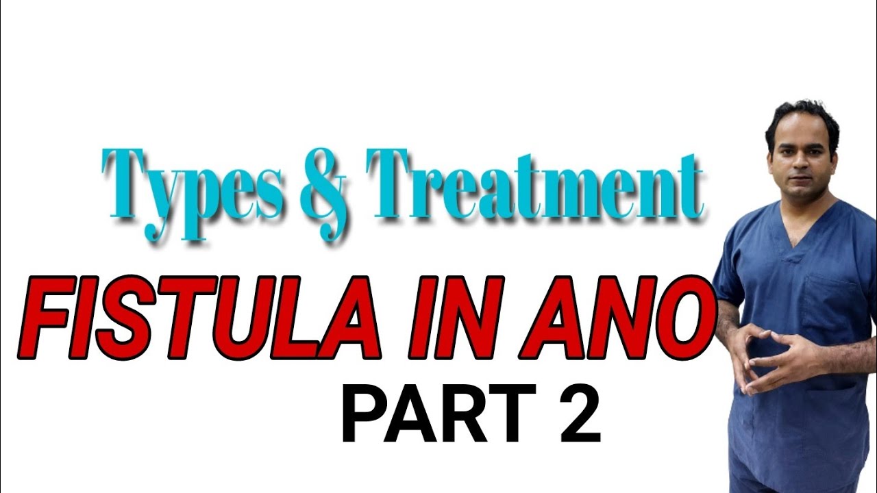 Fistula in Ano | Types & Treatment | Perianal Fistula | Part 2 | Dr ...