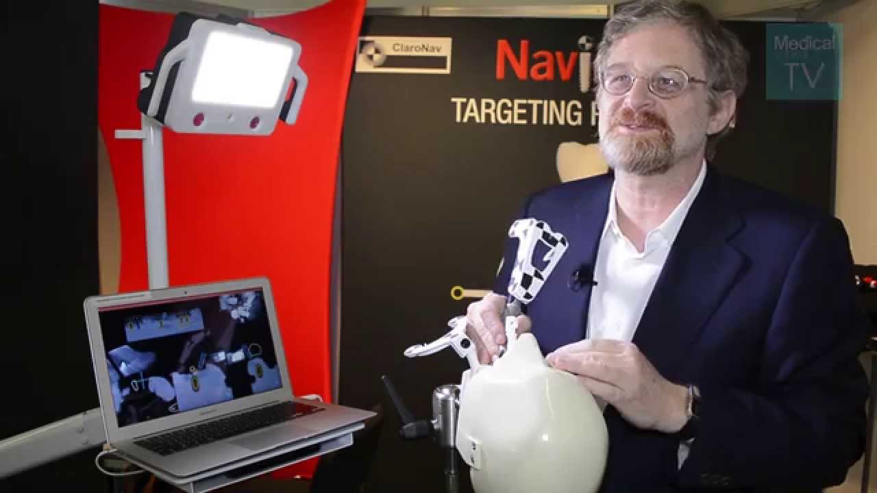 ClaroNav: A GPS for Dentists - YouTube