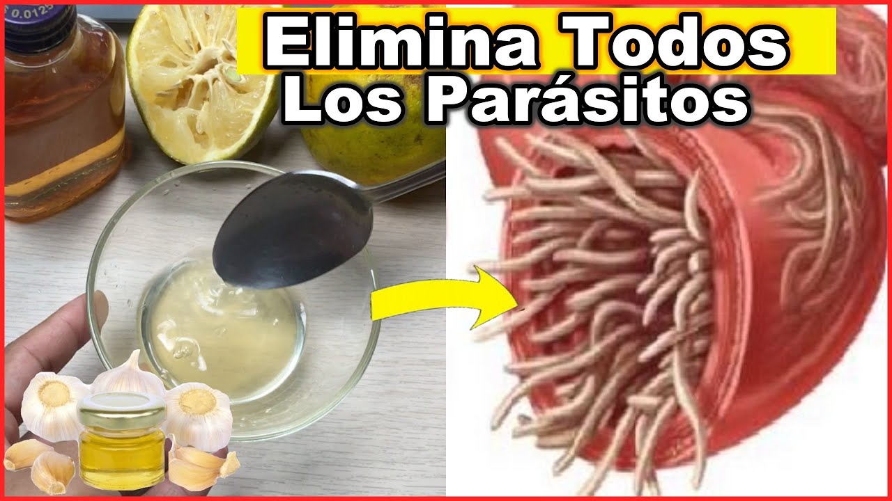 EXPULSA TODO PARÁSITO, LOMBRIZ, O AMEBA DE TU CUERPO EN 5 DÍAs - YouTube