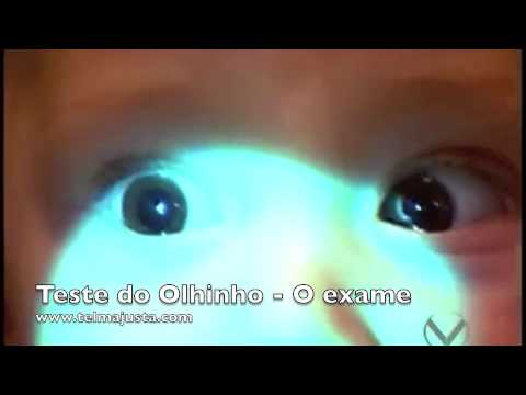 teste do olhinho - YouTube