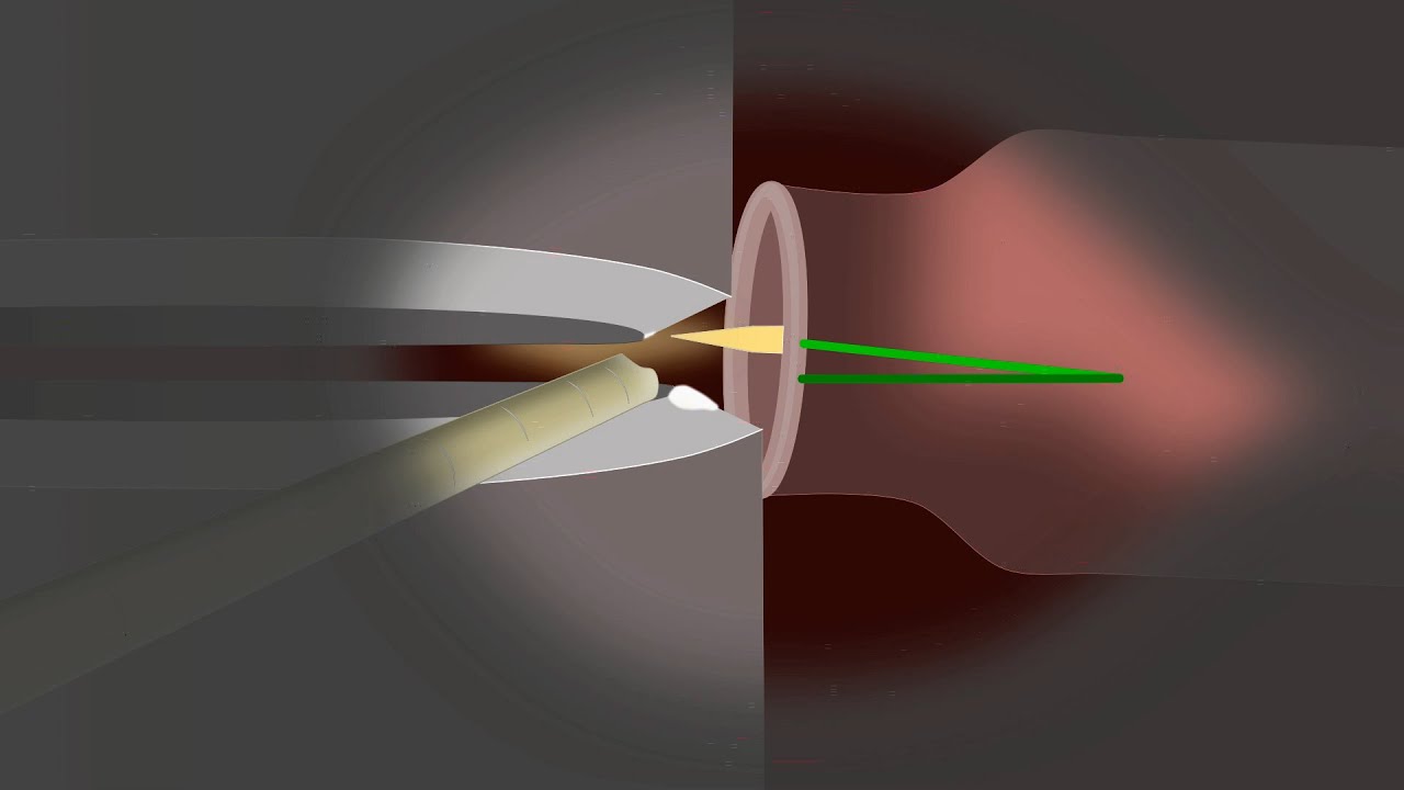 TIG-WELDING TIPS FOR BEGINNER - Horizontal root edge shift - YouTube