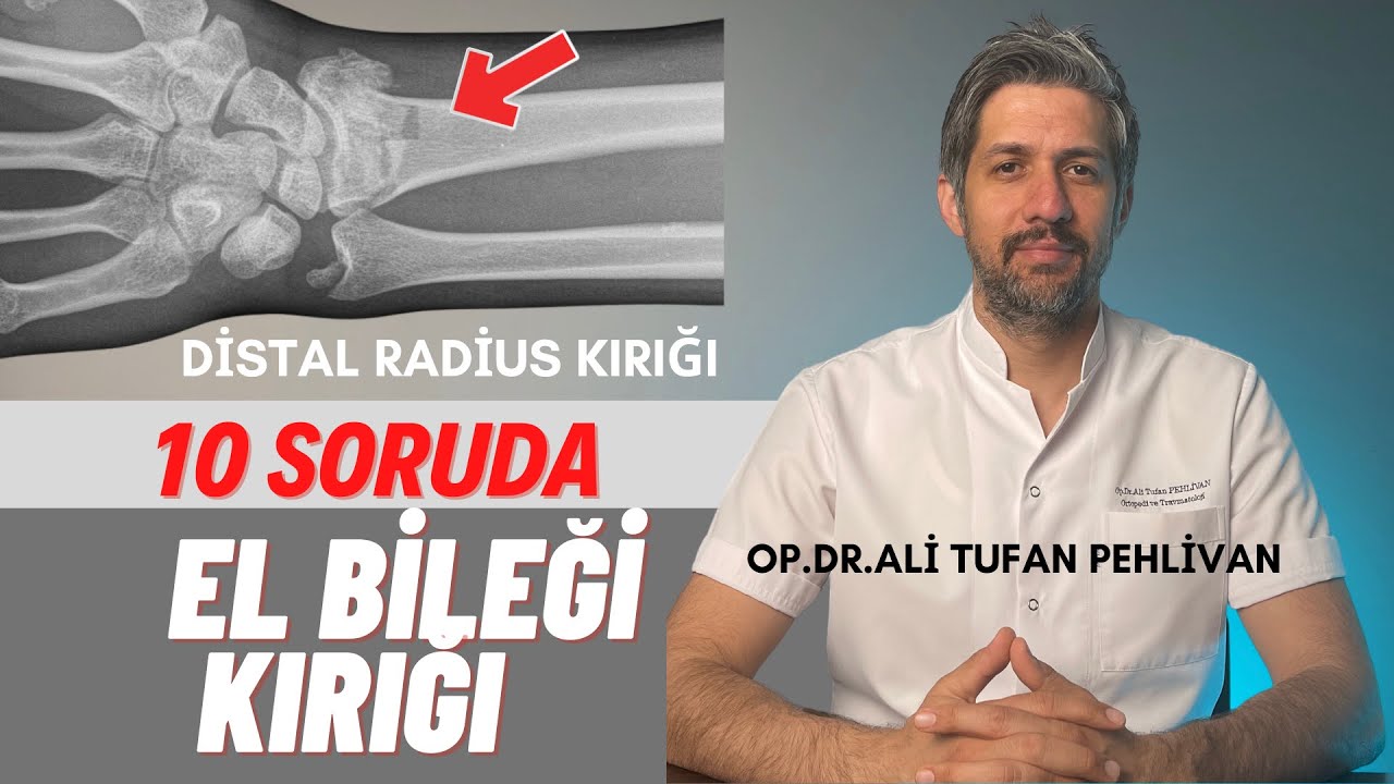 El Bileği Kırığı Nedir// El Bileği Kırığı Nasıl Tedavi Edilir? - YouTube