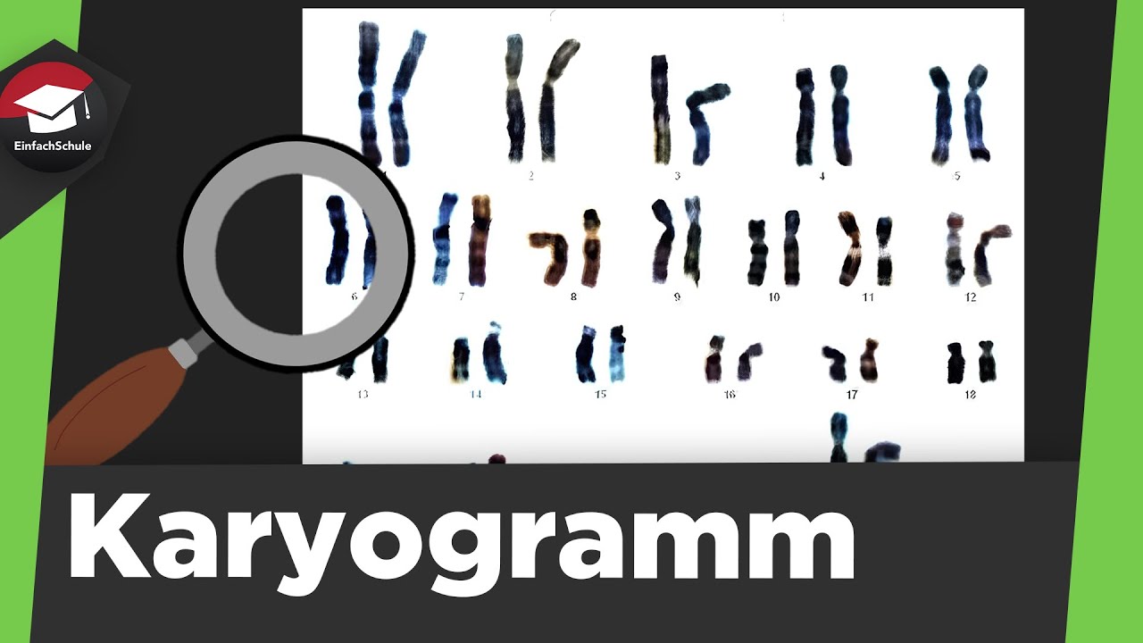 Karyogramm einfach erklärt -Herstellung, Funktion, Arten von Mutationen ...