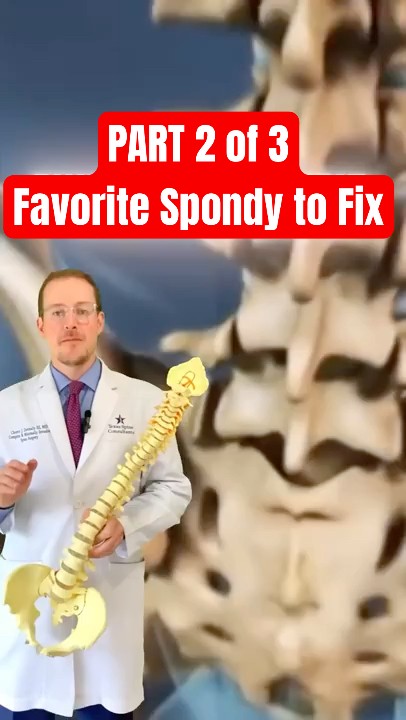 Spondy- Favorite Spine Issue to FIX 🏆 - YouTube