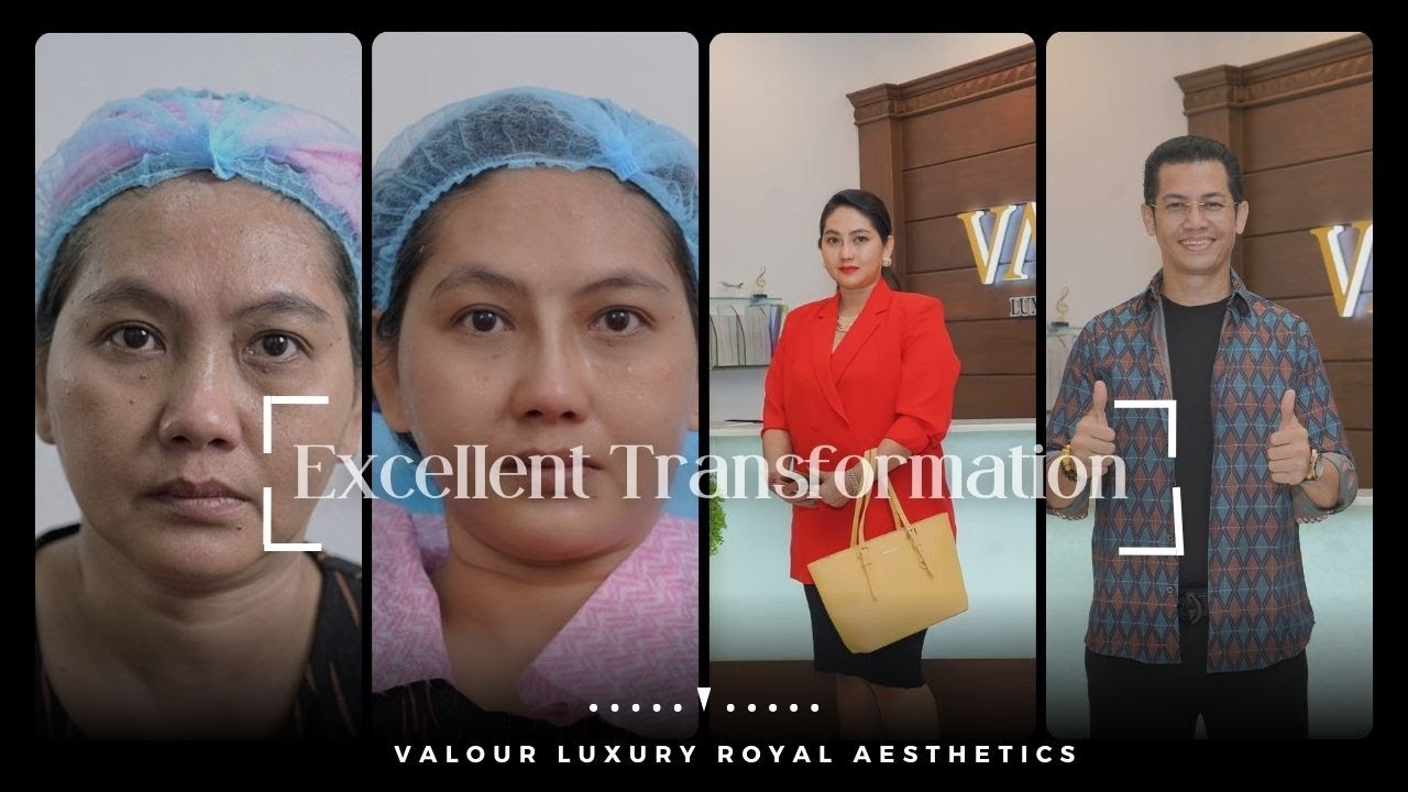 Real Life, Real Change & Excellent Transformation - YouTube