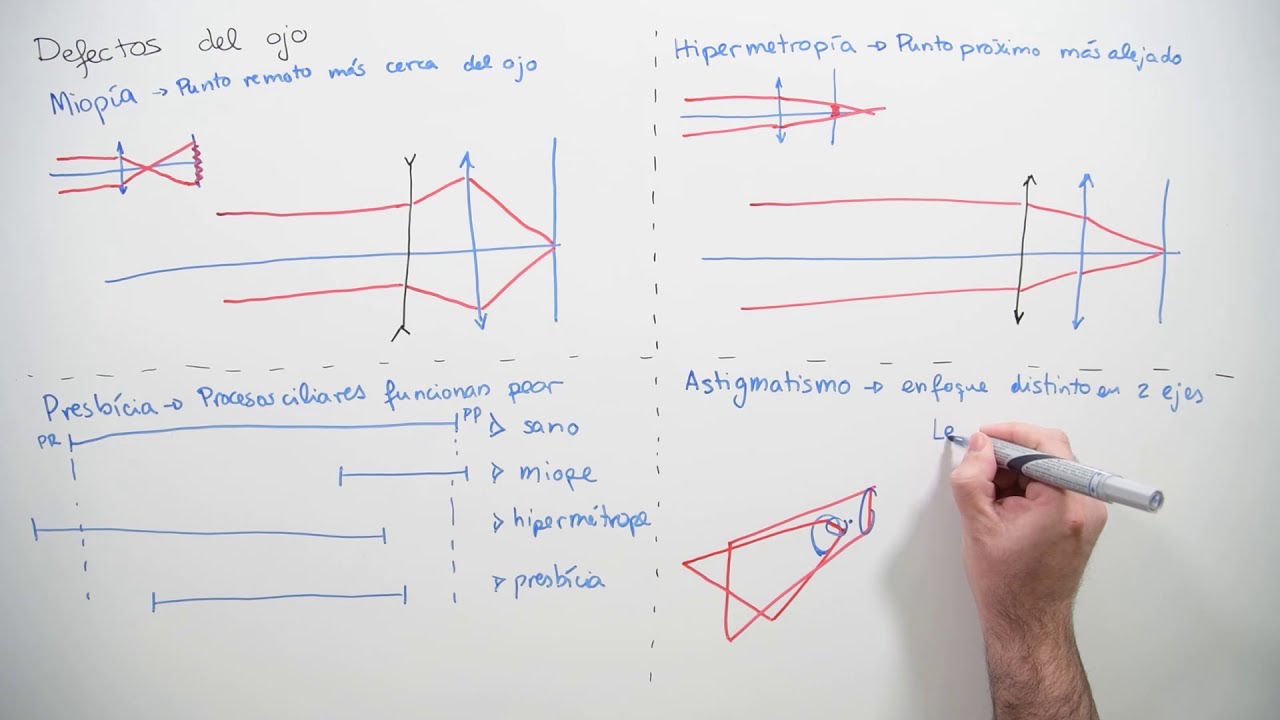 Defectos del ojo - YouTube