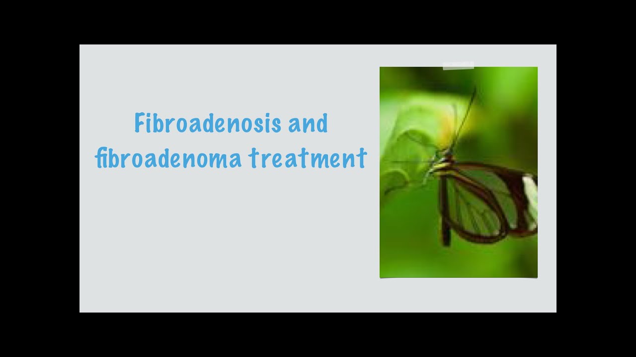 Fibroadenosis and fibroadenoma treatment # medicohelp.com# breast tumor ...