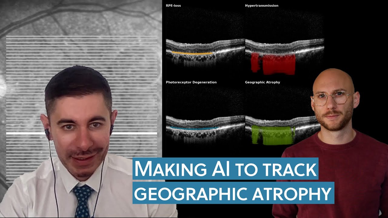 Geographic atrophy quantified and tracked using AI in secconds - YouTube