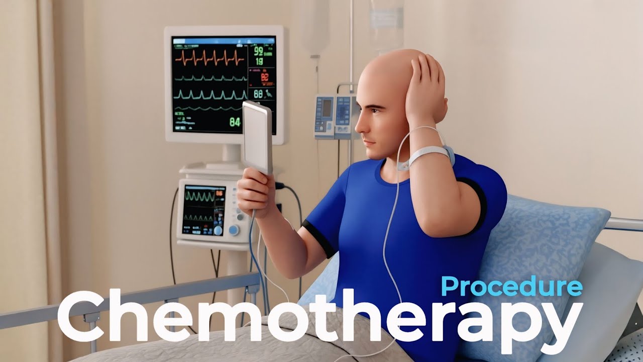 How Chemotherapy Is Done? (3D Animation) | The Scopic Vision - YouTube