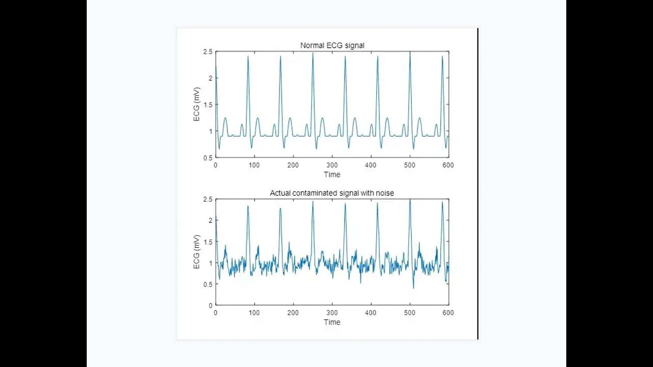 one-dimensional signal denoising algorithm based on adaptive filtering least mean square ...