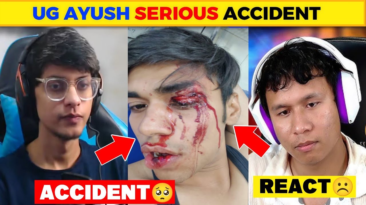 VERY SERIOUS😱 - UG AYUSH Very Serious Car Accident😱☹️ || Tonde gamer, X Mania React😱😱 - YouTube