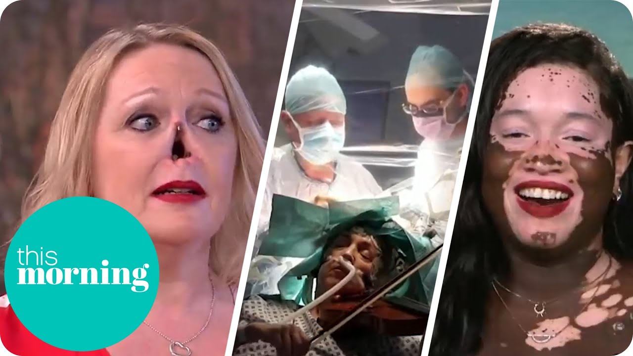 Rare Medical Conditions: Our Guests Share Their Stories | This Morning ...