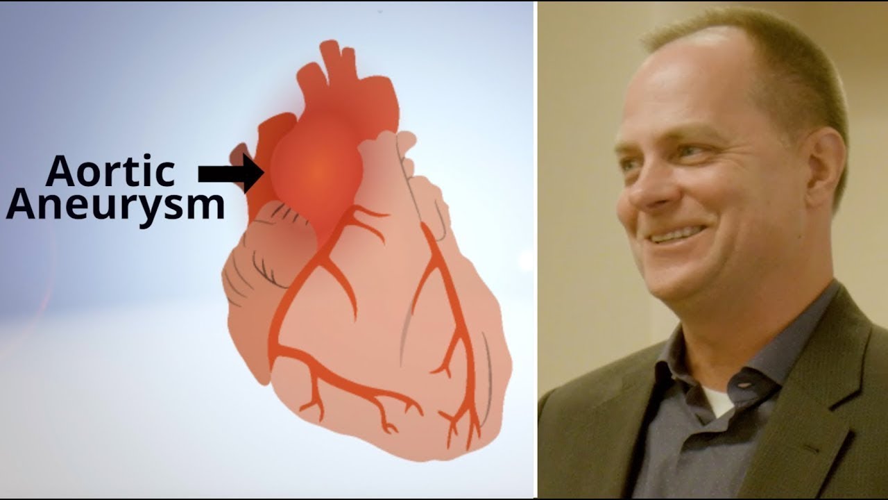 Patient Success Story: Tom's Valve Sparing Aortic Root Replacement ...