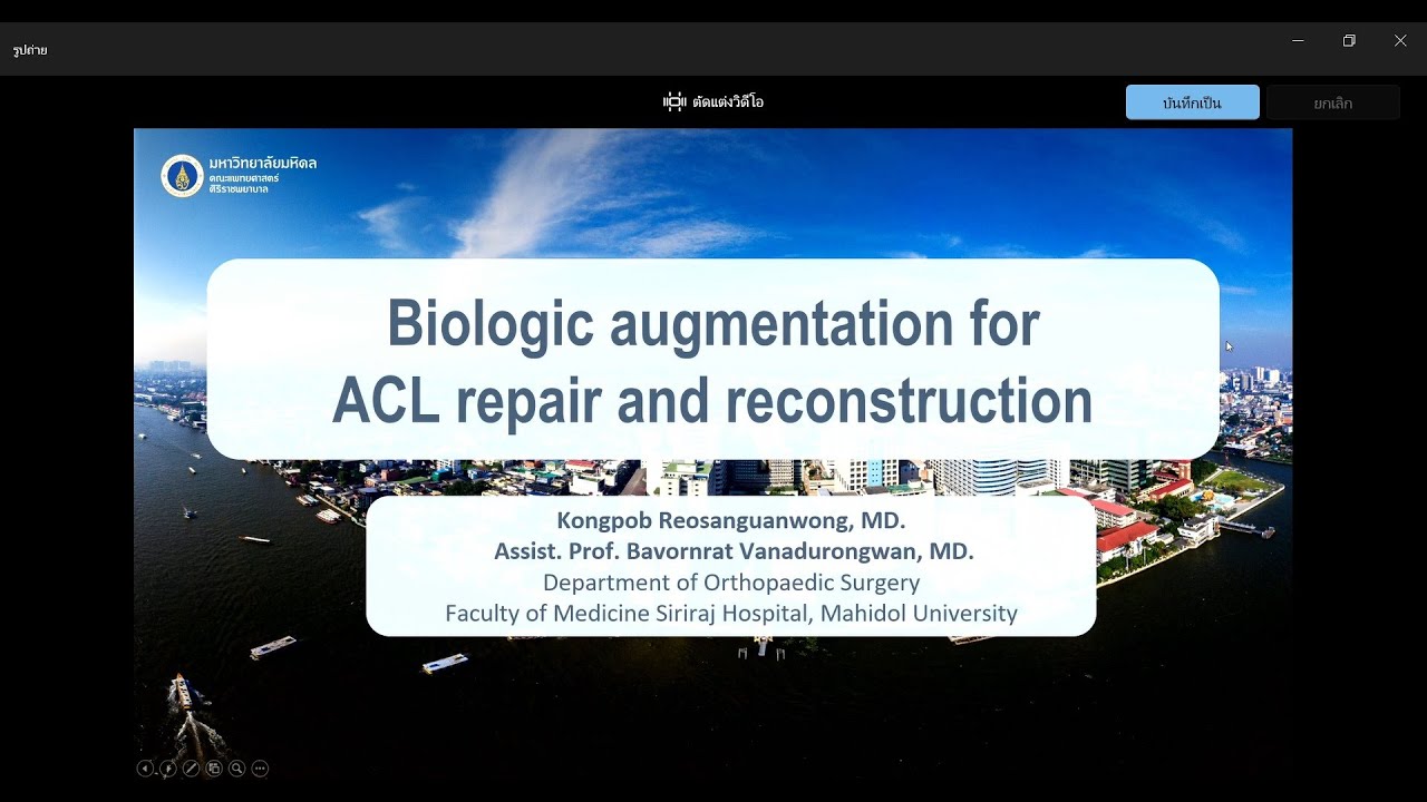 Biological Augmentation for ACL repair and reconstruction - YouTube