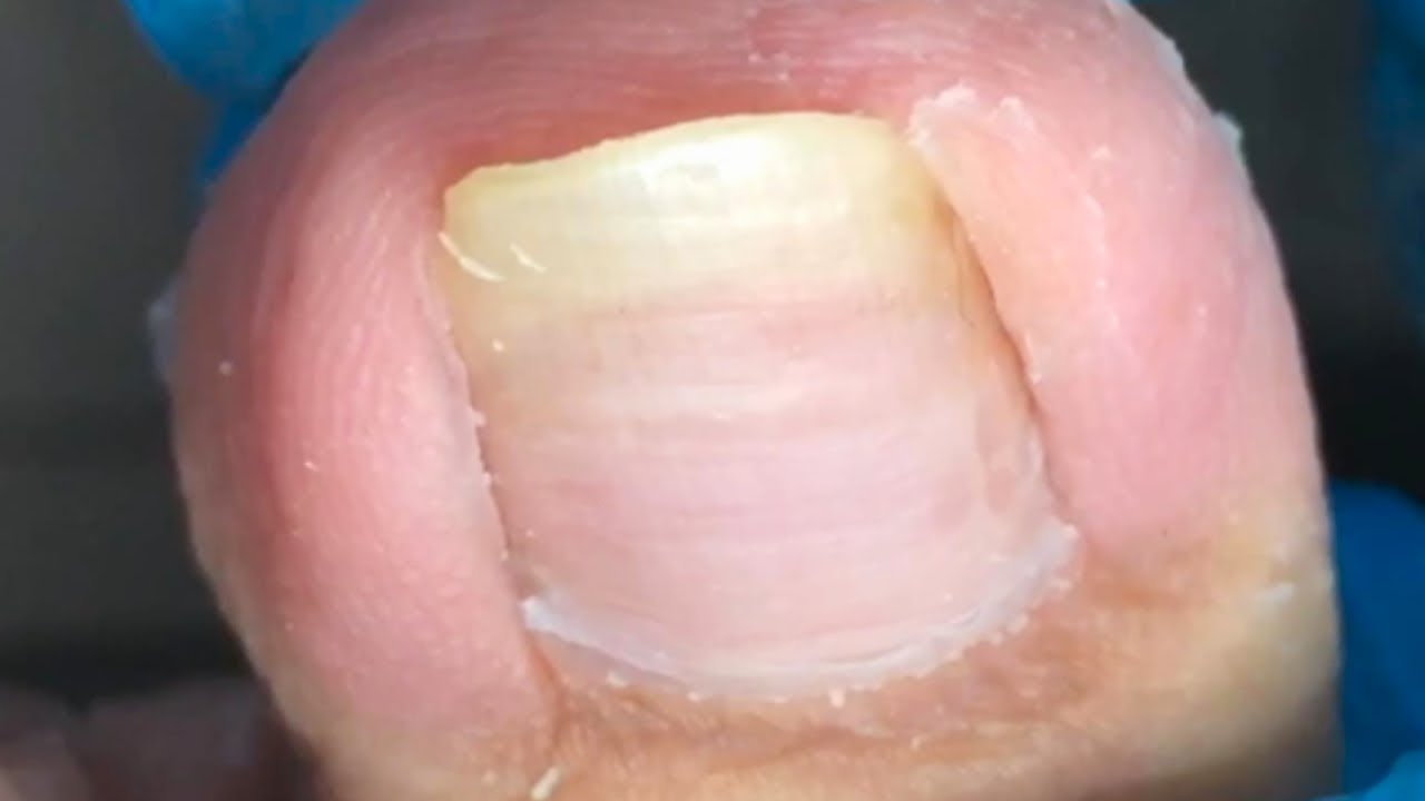 Trim Your Toenails Into A Beautiful Shape~ - YouTube