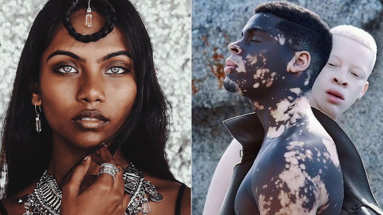 10 Unique People With Rare Beauty Who Are one in a Million - YouTube