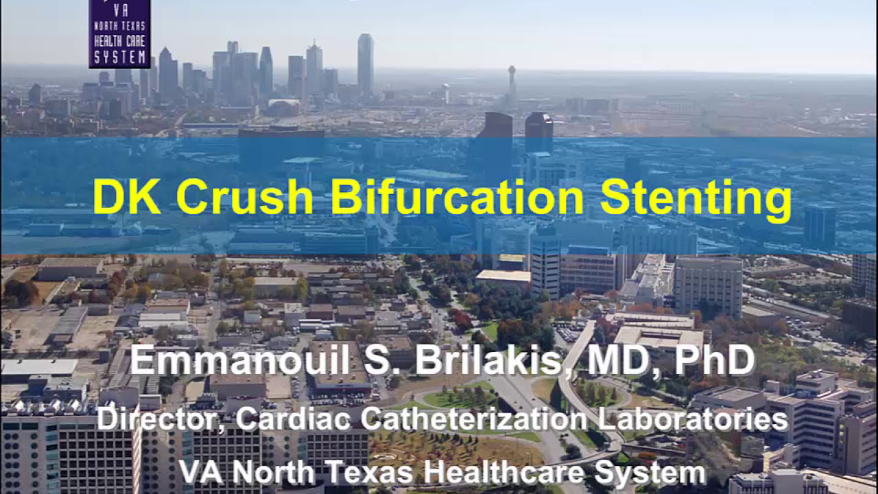 How to perform the DK crush technique for bifurcation stenting - YouTube
