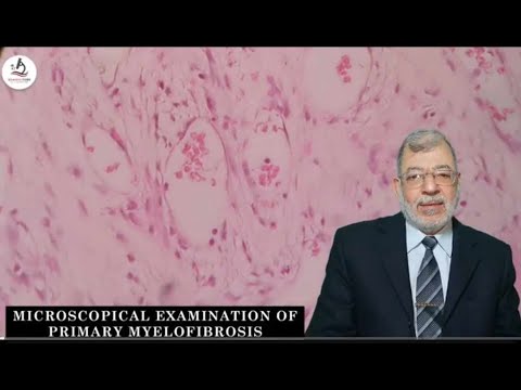 9 Microscopical Exam of MF cases - YouTube