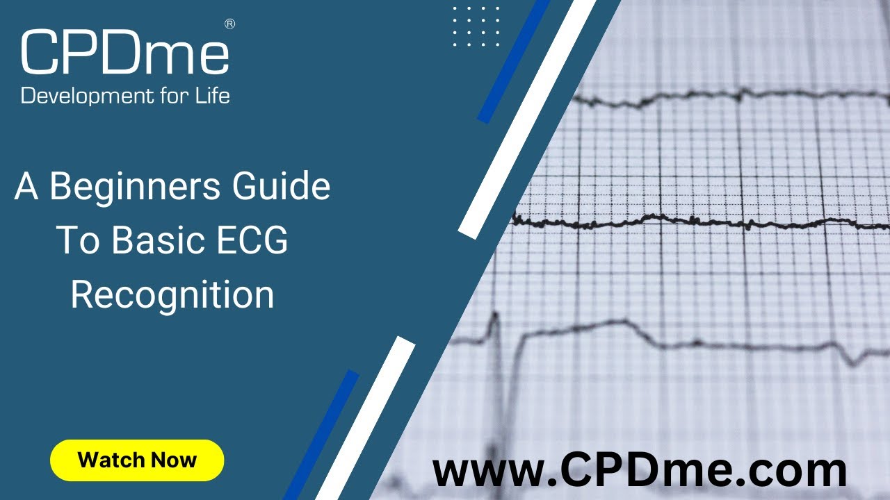 A Beginners Guide To Basic ECG Recognition Presented by Steve Evans MBE ...