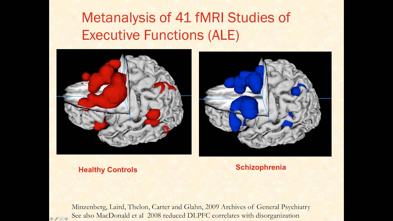 Brain Networks in Schizophrenia and Bipolar Disorder: Targets for Novel ...