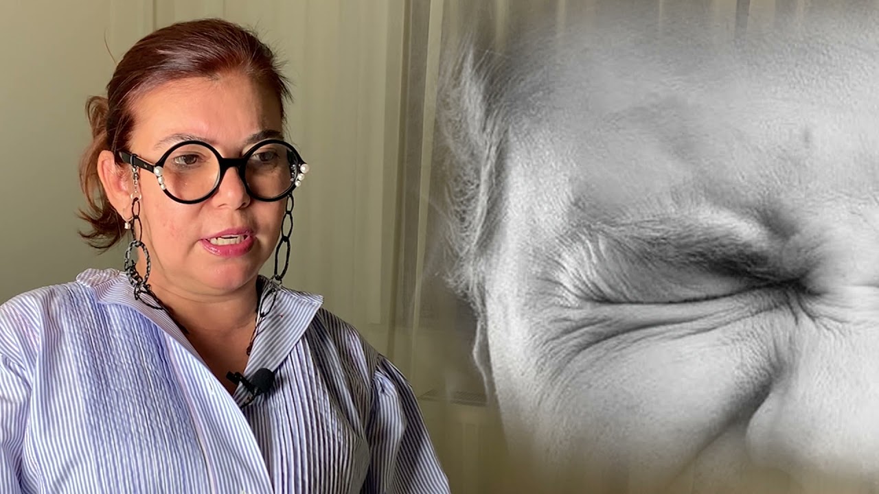 TRATAMENT BLEFAROSPASM | Spasmul ochiului | Clipitul excesiv | Dr Ioana ...