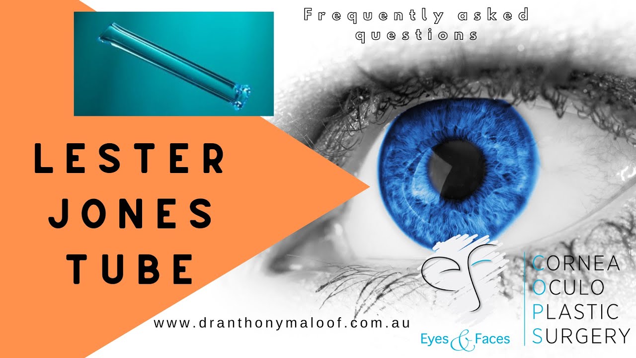 FAQ - Lester Jones Tube - Dr Anthony Maloof Sydney Oculoplastic Surgery ...