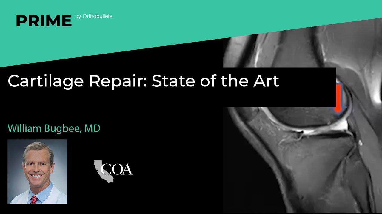 Cartilage Repair: State of the Art - William Bugbee, MD - YouTube
