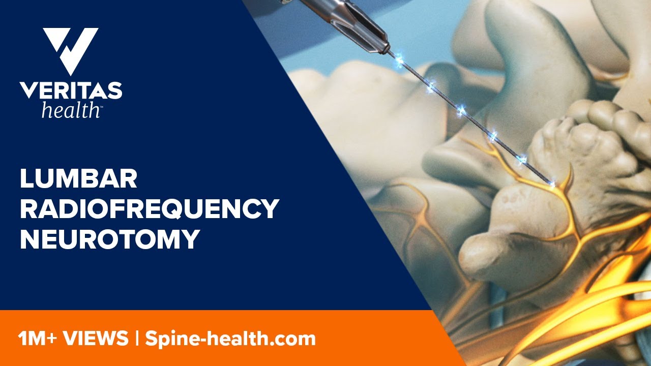 Lumbar Radiofrequency Neurotomy - YouTube
