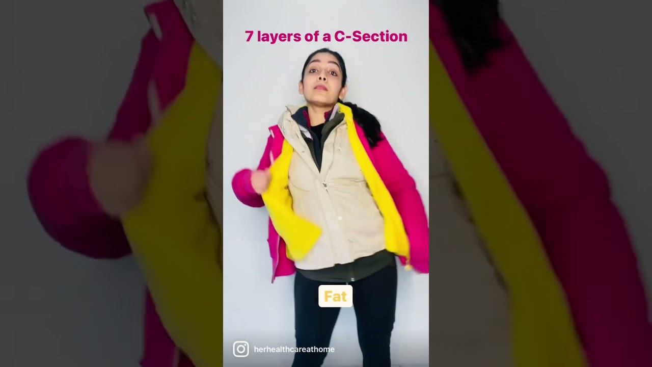 7 layers of a Cesarean Section | C-section layers explained #shorts ...