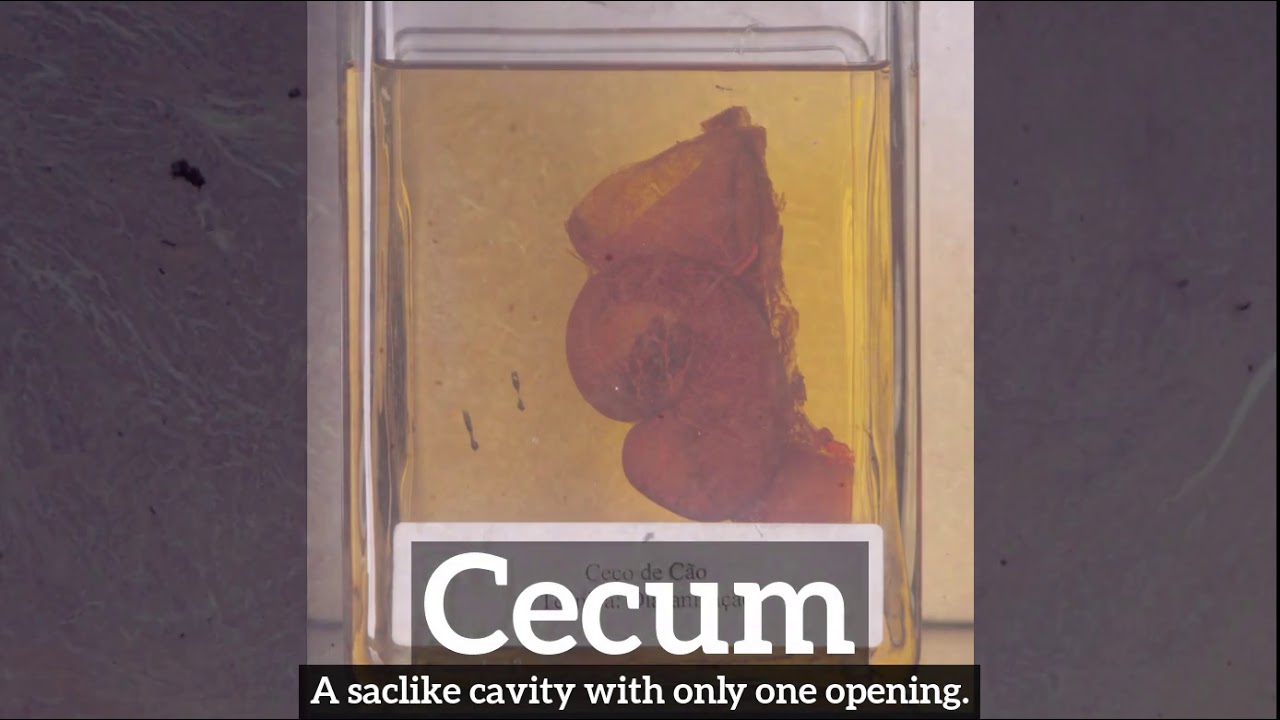 How Does Cecum Look? | How to Say Cecum in English? | What is Cecum ...