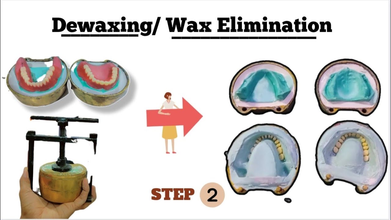 Dewaxing or Wax Elimination in processing of complete denture | Step-2 ...