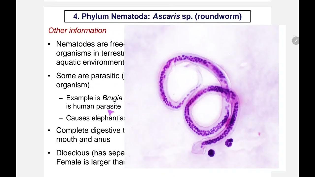 1.6 (g) Phylum Nematoda_ roundworm - YouTube