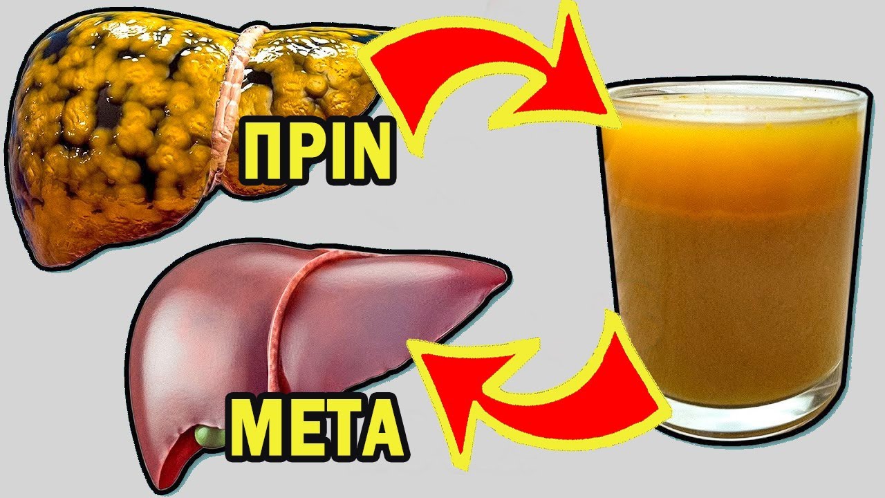 100% Αποτέλεσμα! ΜΟΝΟ 1 Ποτήρι Για Αποτοξίνωση Του Συκωτιού & Χολής ...