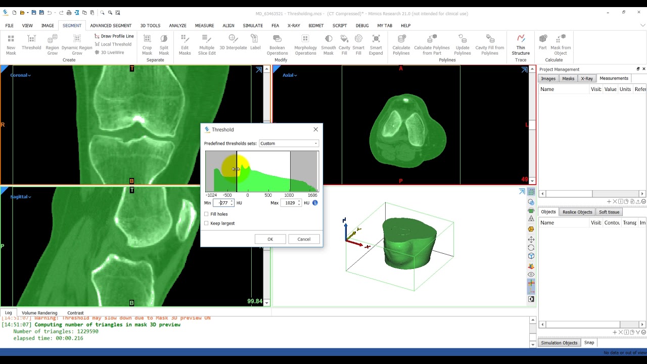 How to Perform Thresholding in Mimics | Mimics Innovation Suite ...