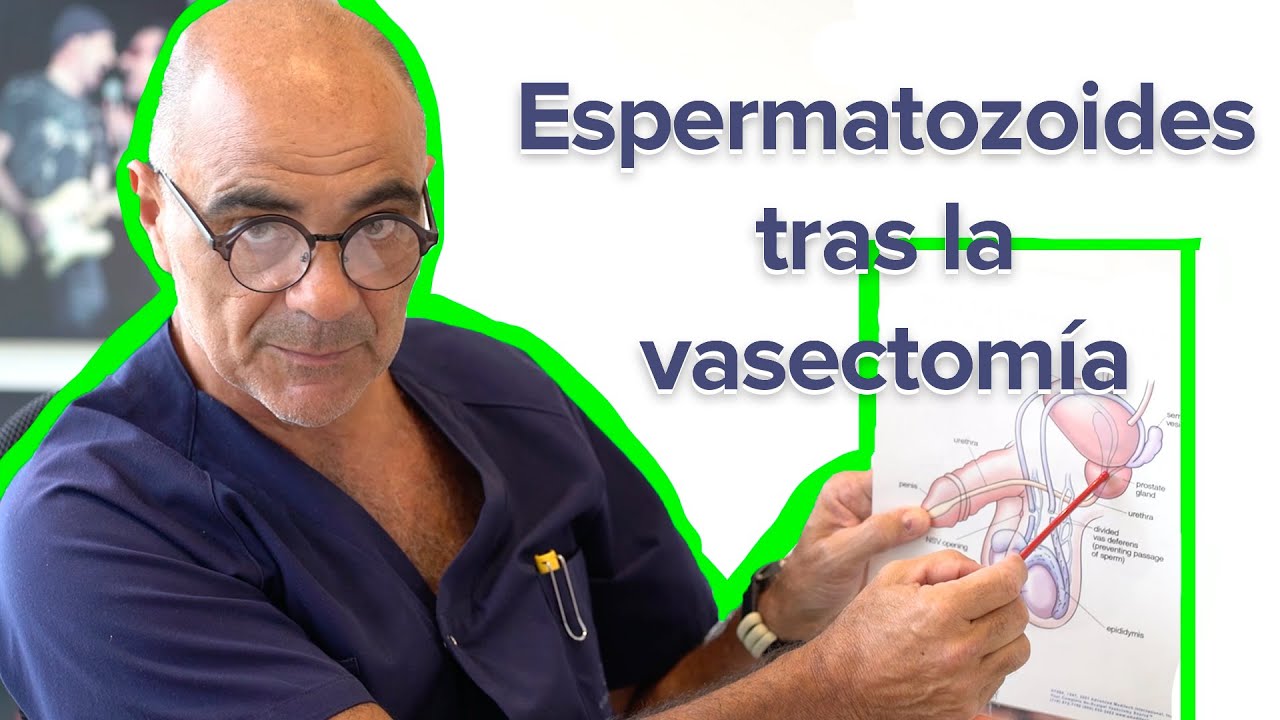 Espermatozoides tras la vasectomía - Doctor Viladoms - Teknon - #013 - YouTube