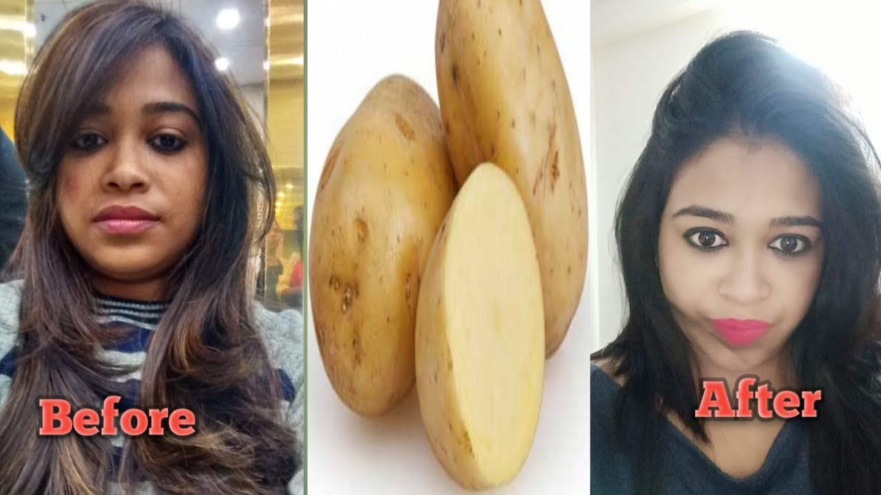 Potato Face Pack For Skin Whitening, Hyperpigmentation, Spotless, fair ...