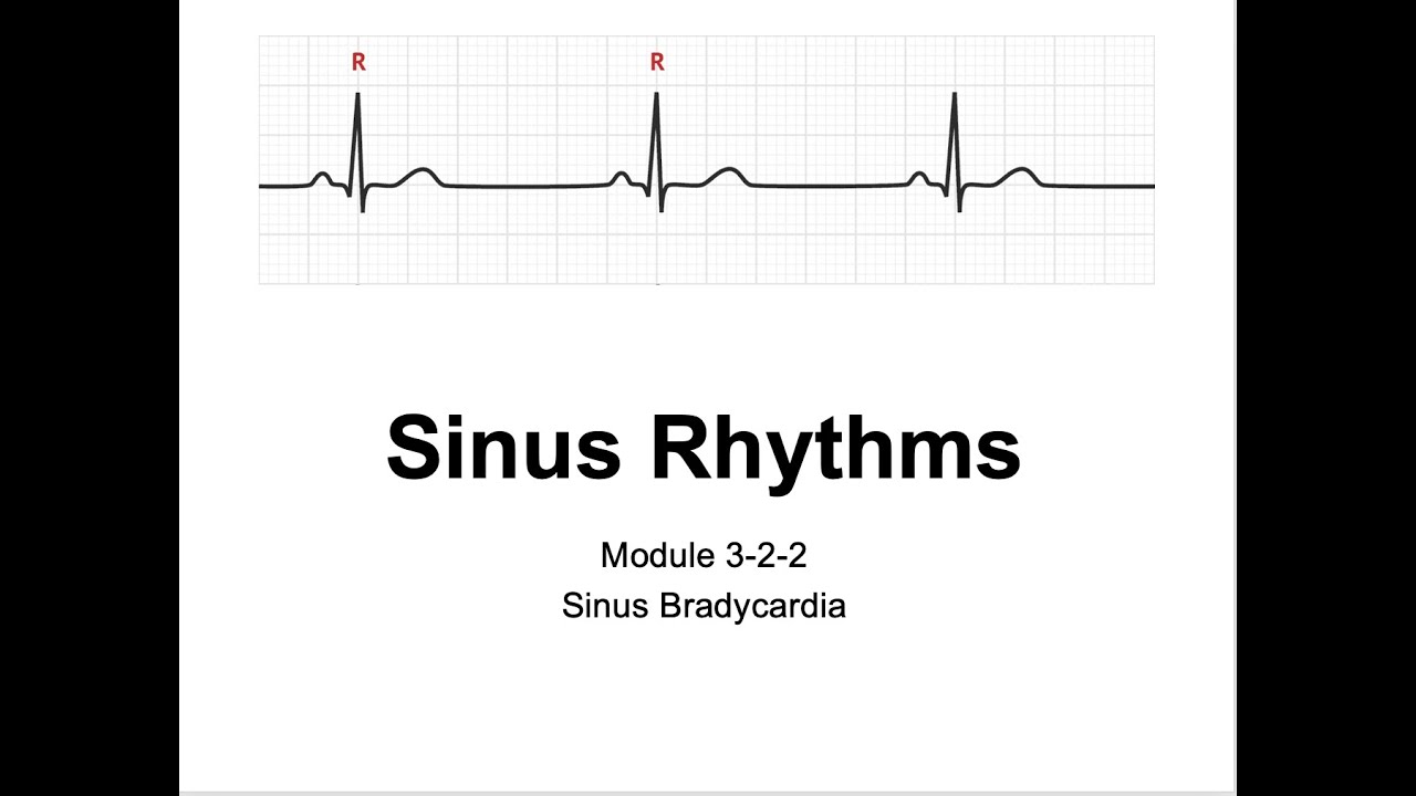 Paramedic Cardiology Module 3-1 Lecture 2: Sinus Bradycardia - YouTube