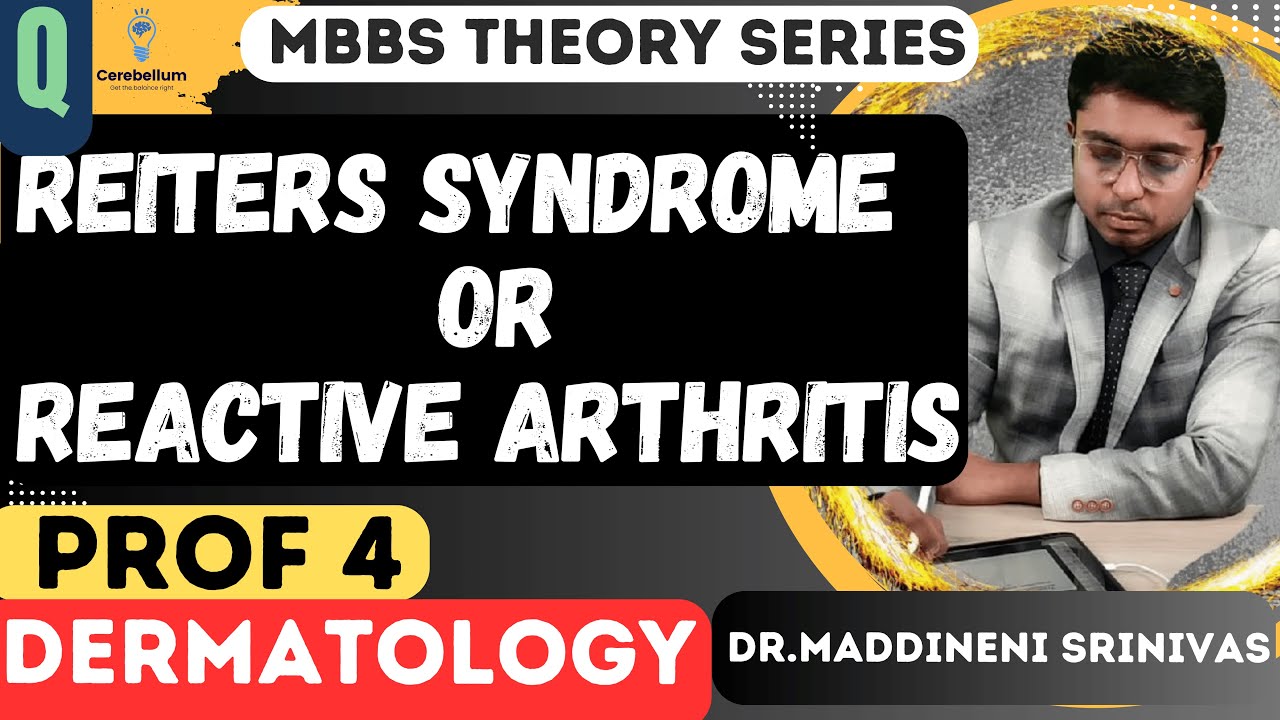 Reiters syndrome | REACTIVE ARTHRITIS | Dermatology for 4th year MBBS ...