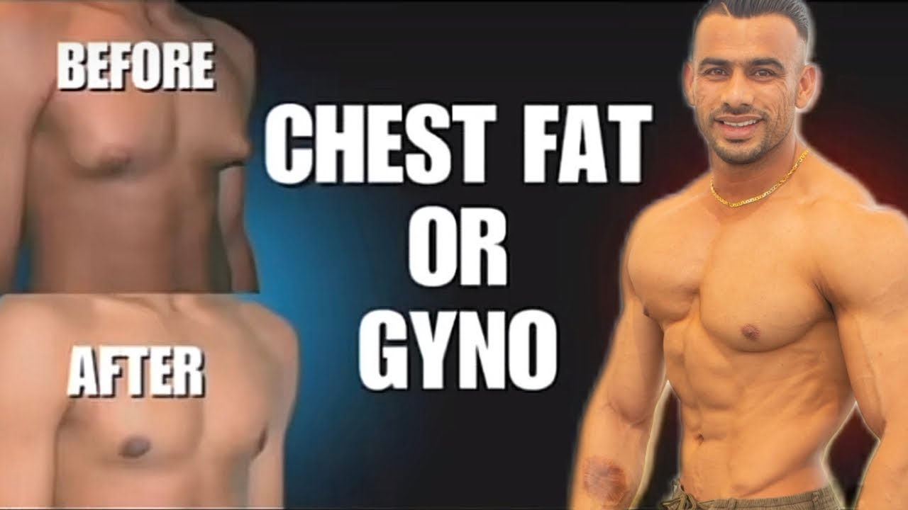 Gyno or Chest Fat | What is Gyno | Man Boobs | - YouTube