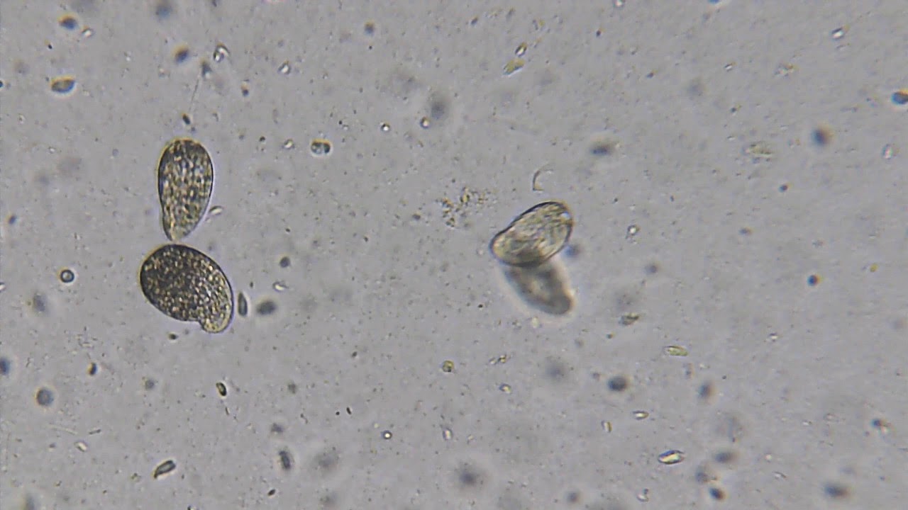 Colpidium colpoda (?) - YouTube
