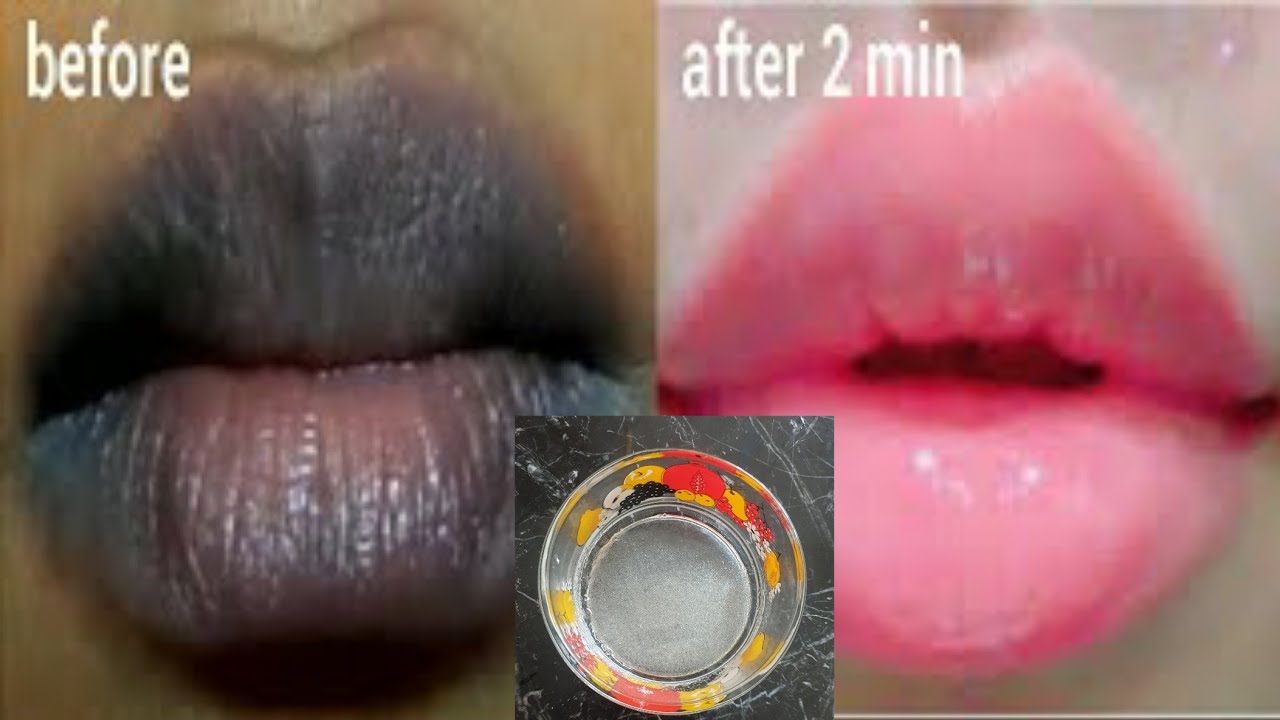 In Just 2 Minutes, Turn Dark Black Lips Into Baby Pink and Beautiful ll ...